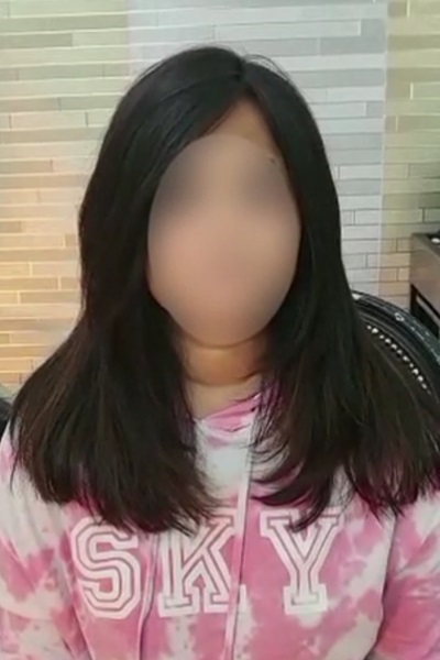 Hair replacement systems for women at Birmingham hair loss clinic